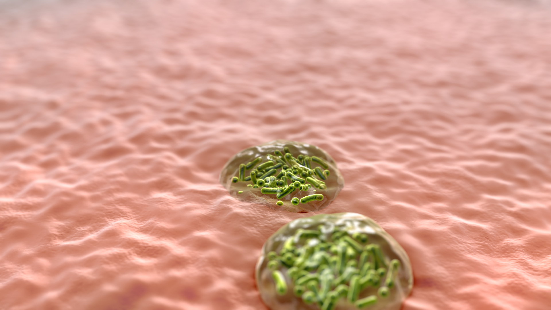 Limpiar y acabar con el Biofilm | Urgo Medical