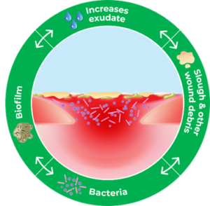 Acrónimo PIEL: Guía Práctica para el Abordaje Local de Heridas | Urgo ...
