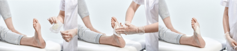 UrgoStart Plus Border | Urgo Medical